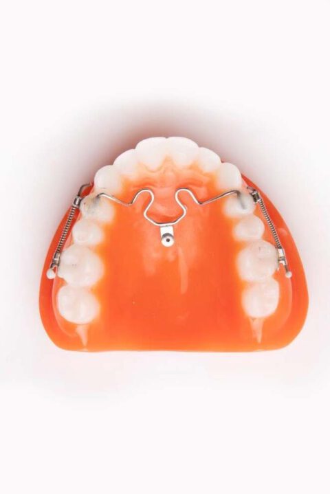 Botverankering - Orthodontie Schreurs